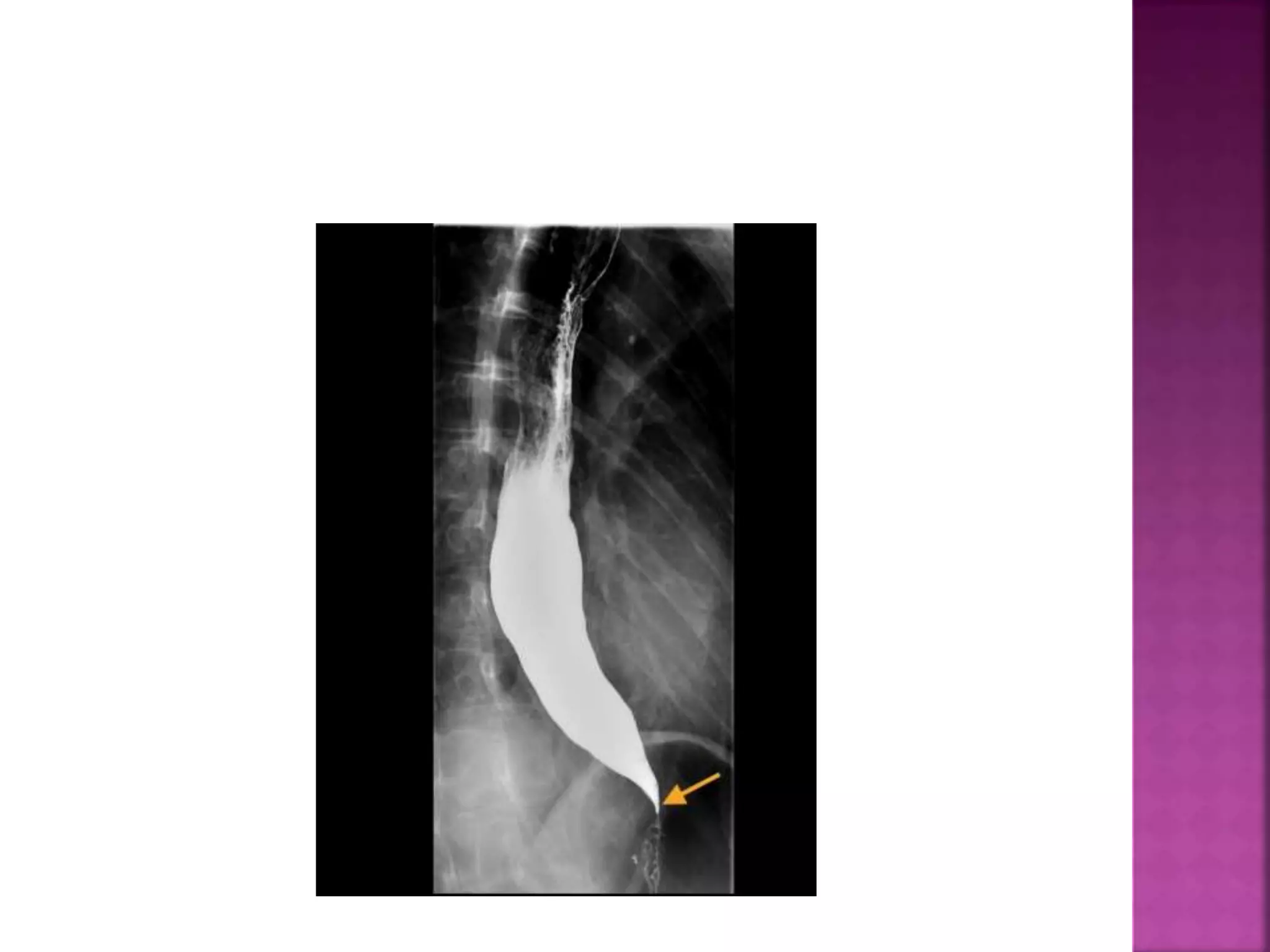 Radiology in ent | PPTX
