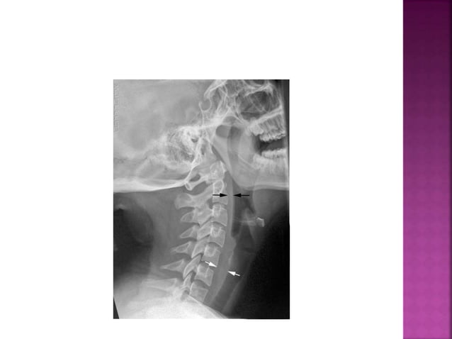 Radiology in ent | PPTX | Ear, Nose and Throat Conditions | Diseases ...