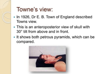 Radiology in Head and Neck by Kanato T Assumi. | PPTX