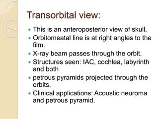 Radiology in Head and Neck by Kanato T Assumi. | PPTX