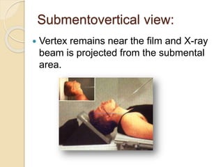 Radiology in Head and Neck by Kanato T Assumi. | PPTX