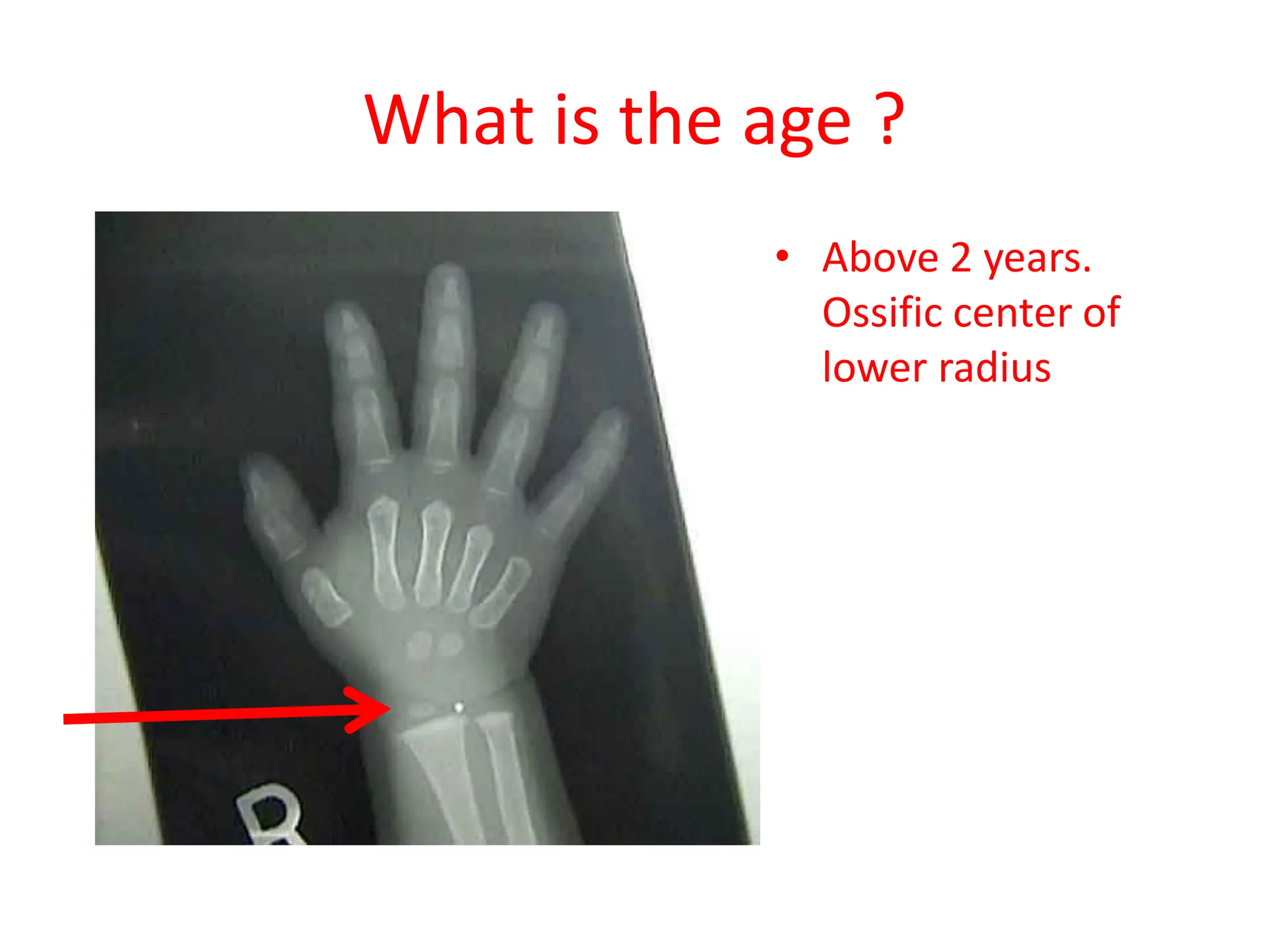 radiology in identification.pdf