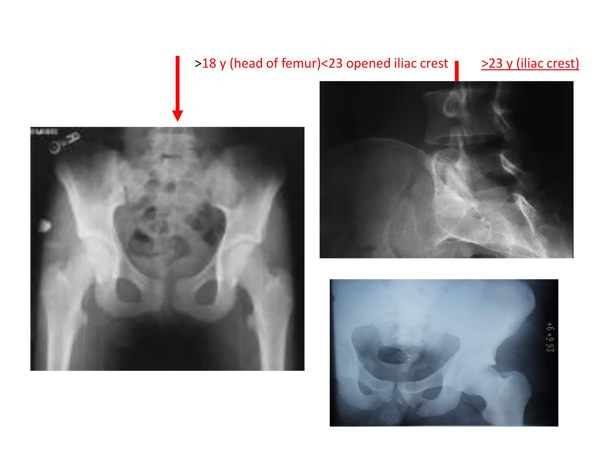 radiology in identification.pdf