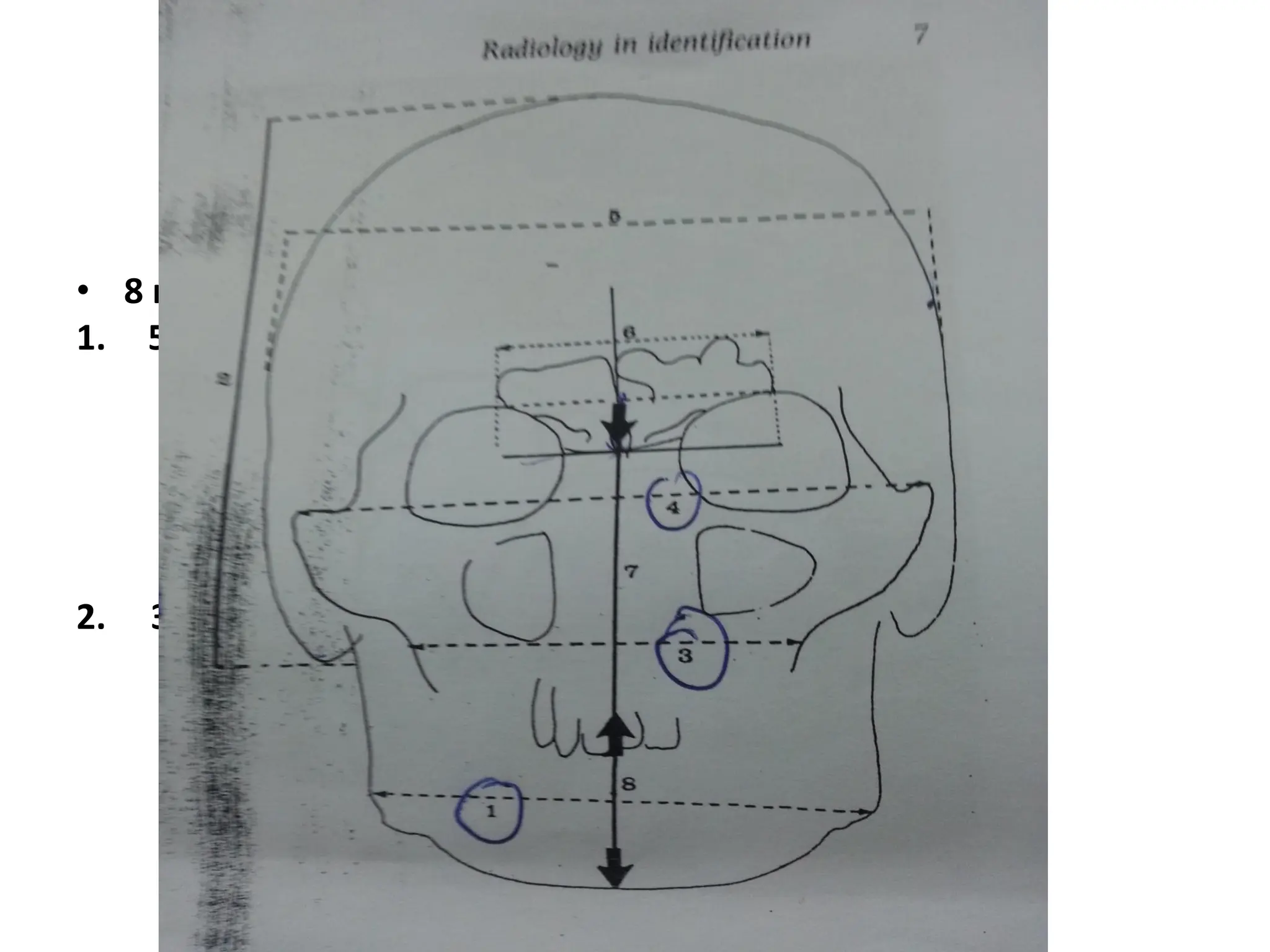 radiology in identification.pdf