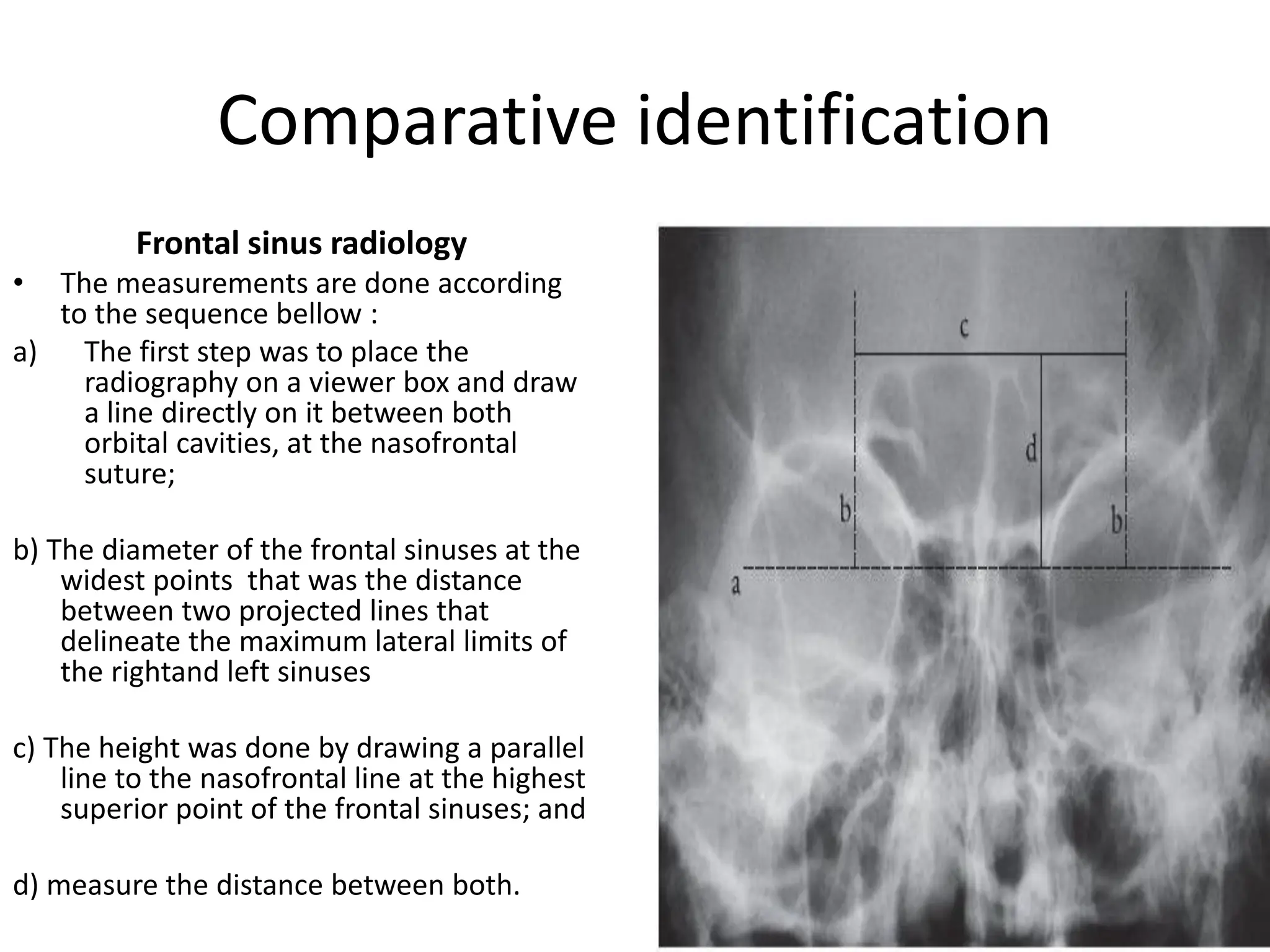 radiology in identification.pdf