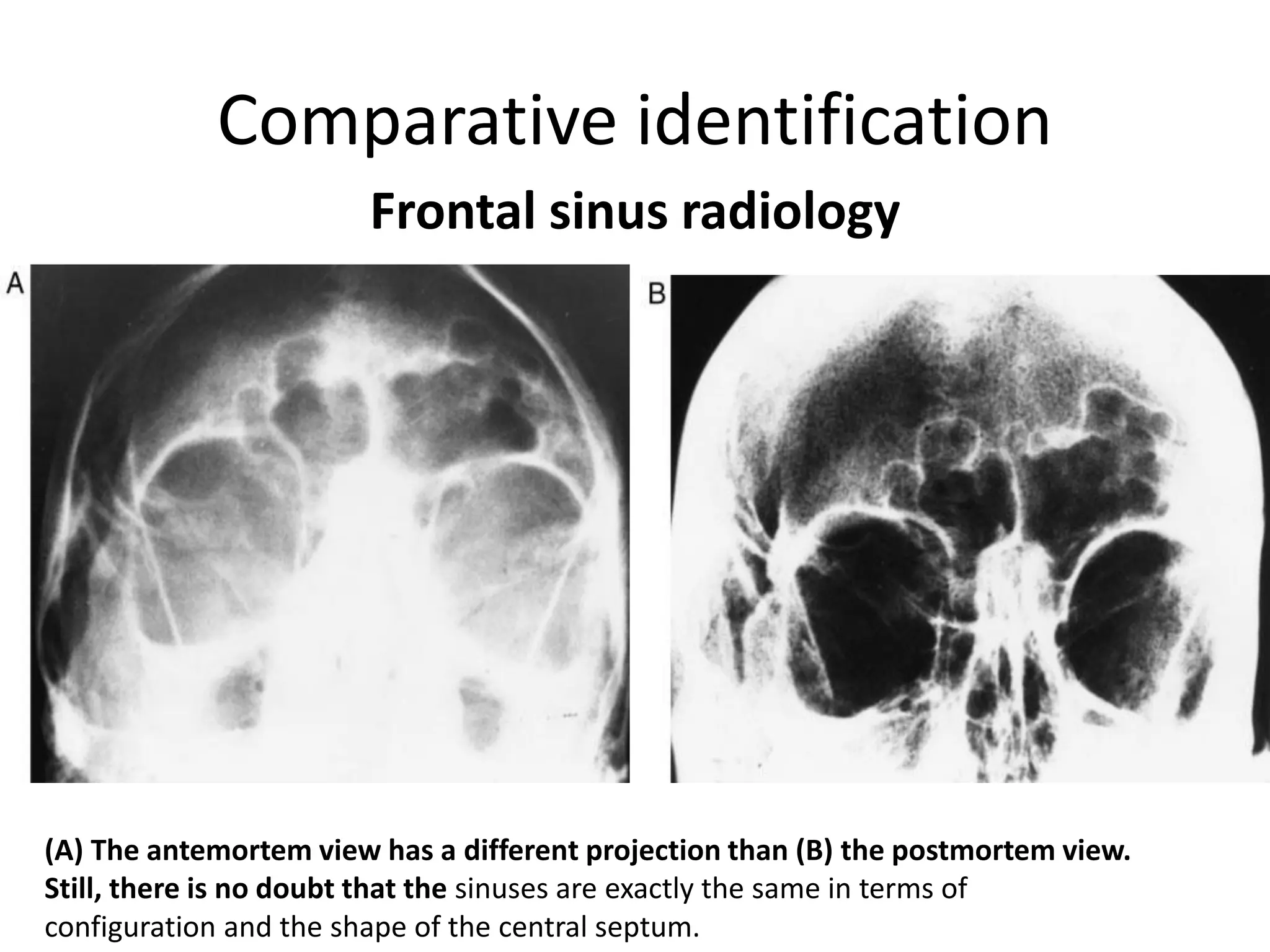 radiology in identification.pdf