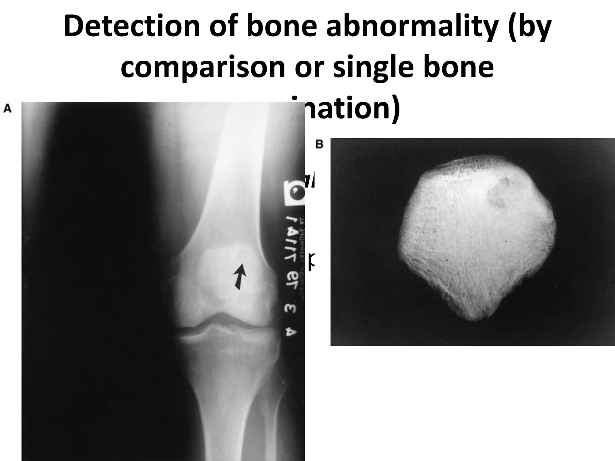 radiology in identification.pdf
