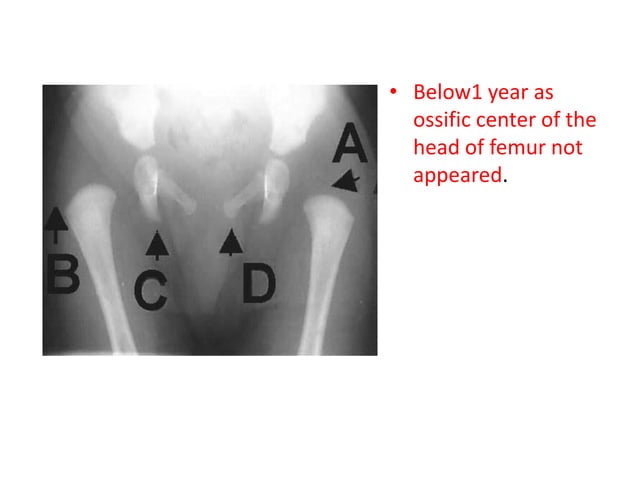 radiology in identification.pdf