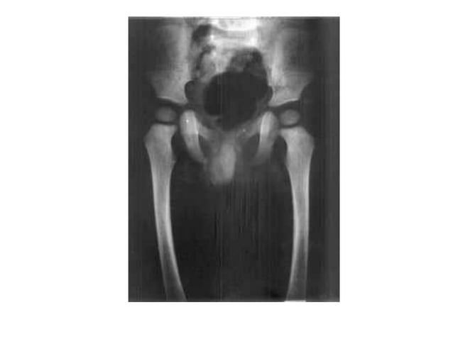 radiology in identification.pdf