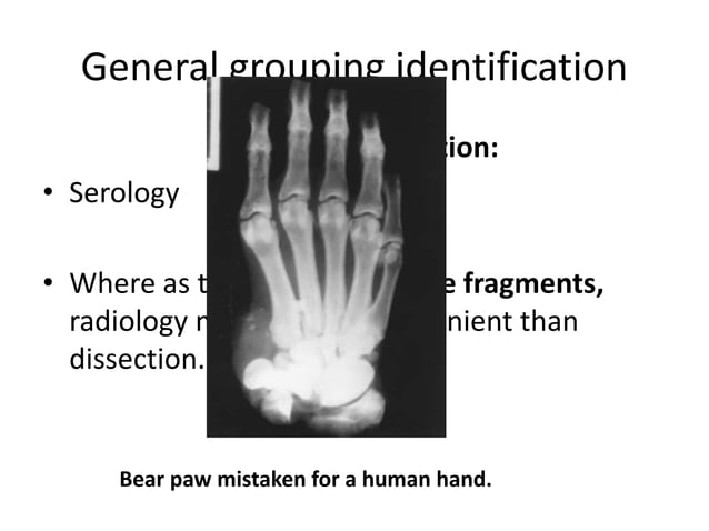 radiology in identification.pdf