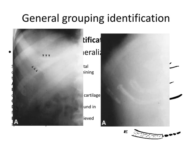 radiology in identification.pdf