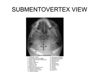 Radiology in maxillofacial_imaging | PPT