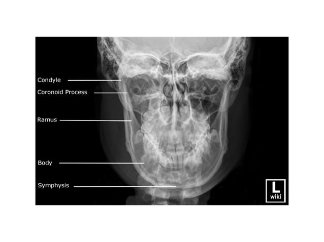 Radiology in maxillofacial_imaging | PPT