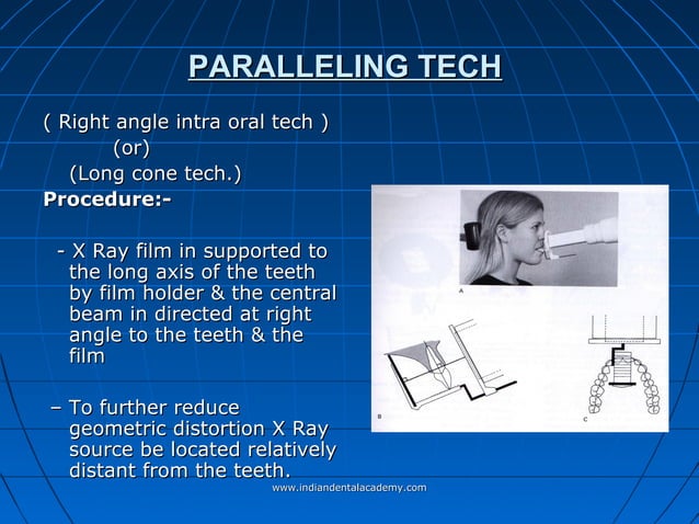 Radiology in orthodontics | PPT