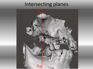 Radiology in planning | PPT