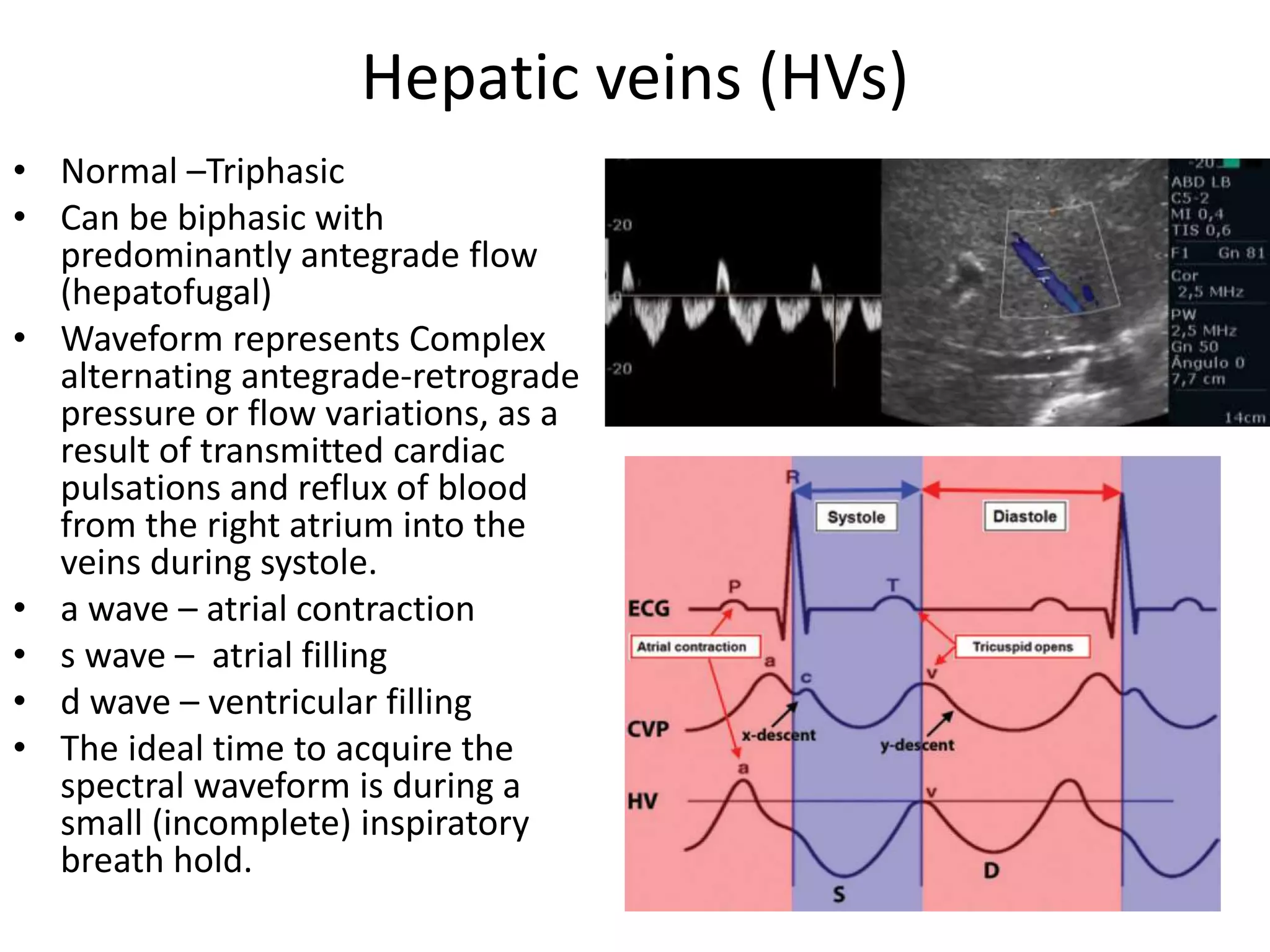 Radiology in portal hypertension | PPTX
