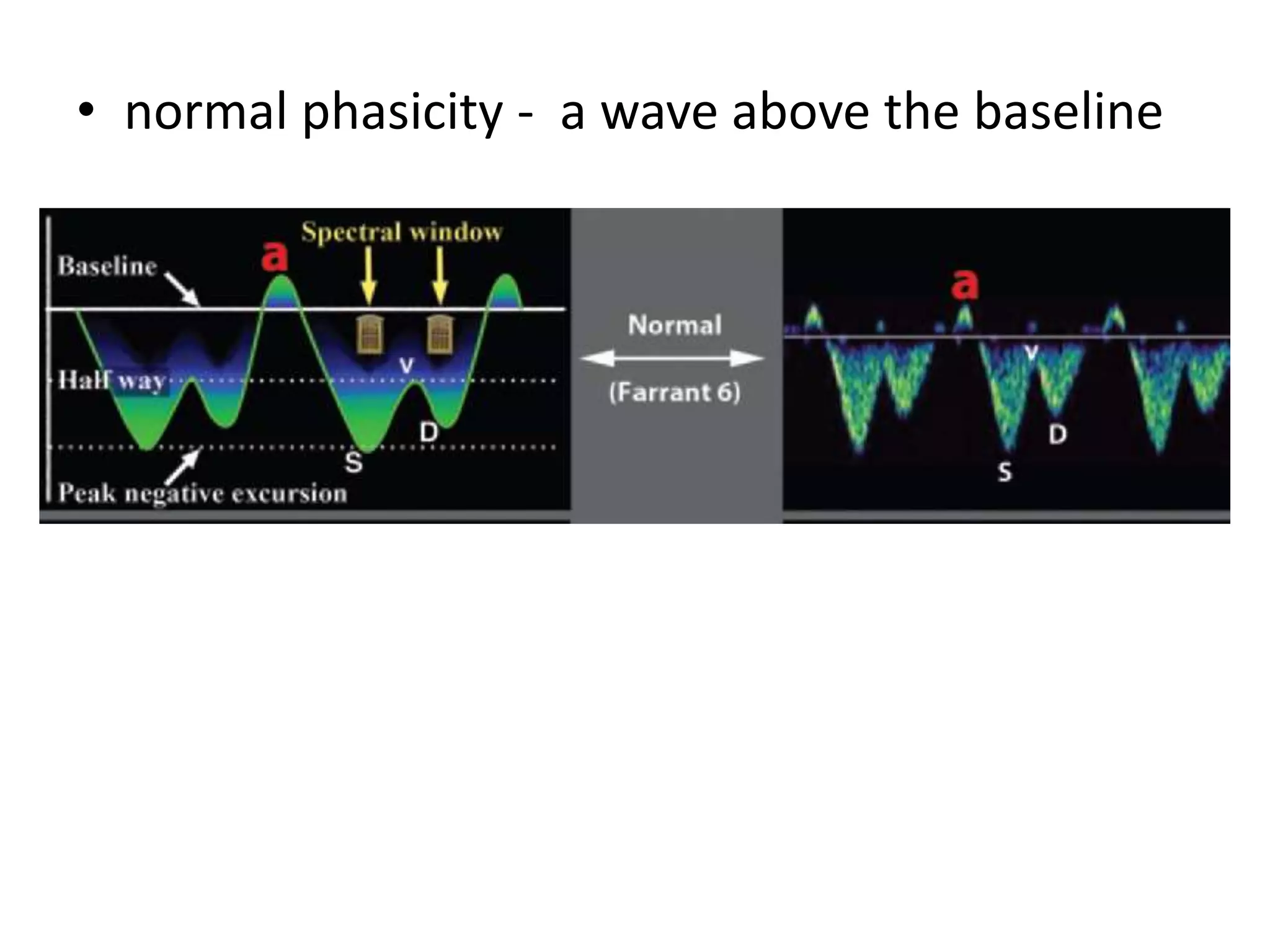 Radiology in portal hypertension | PPTX