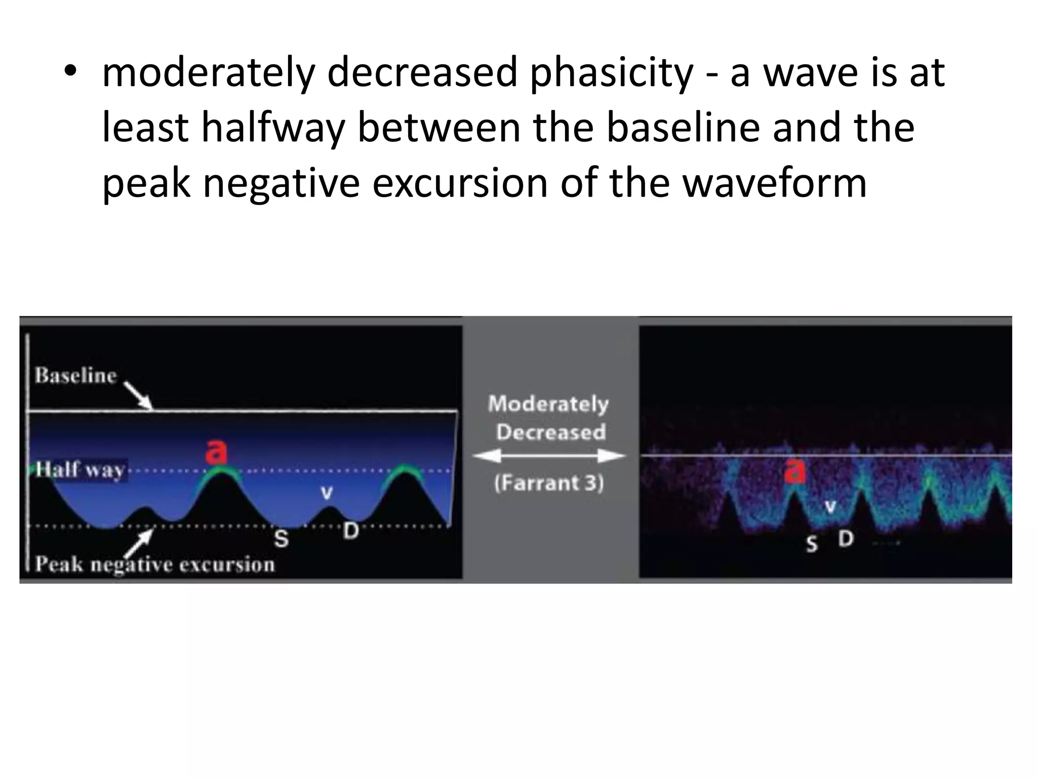 Radiology in portal hypertension | PPTX