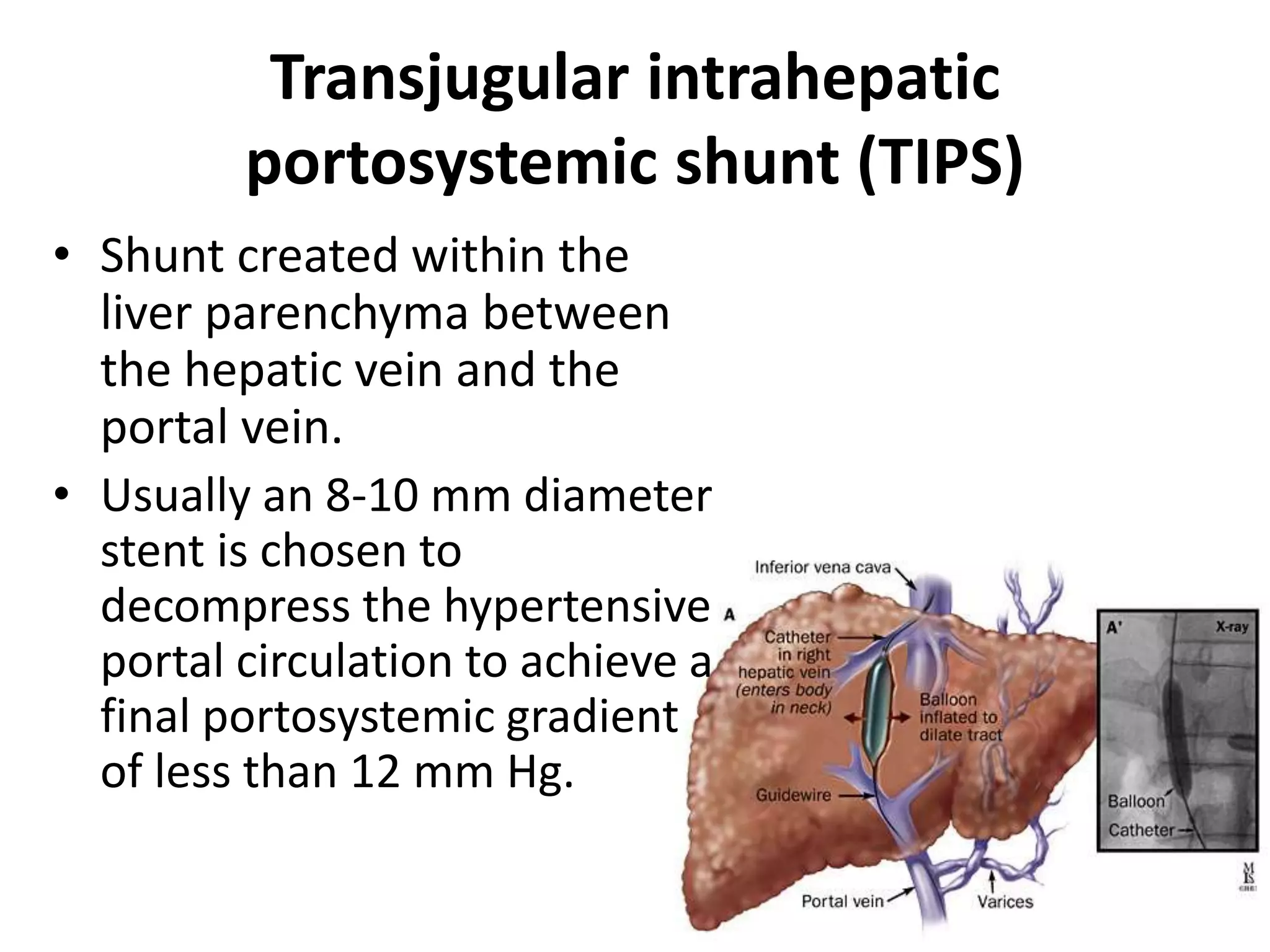 Radiology in portal hypertension | PPTX