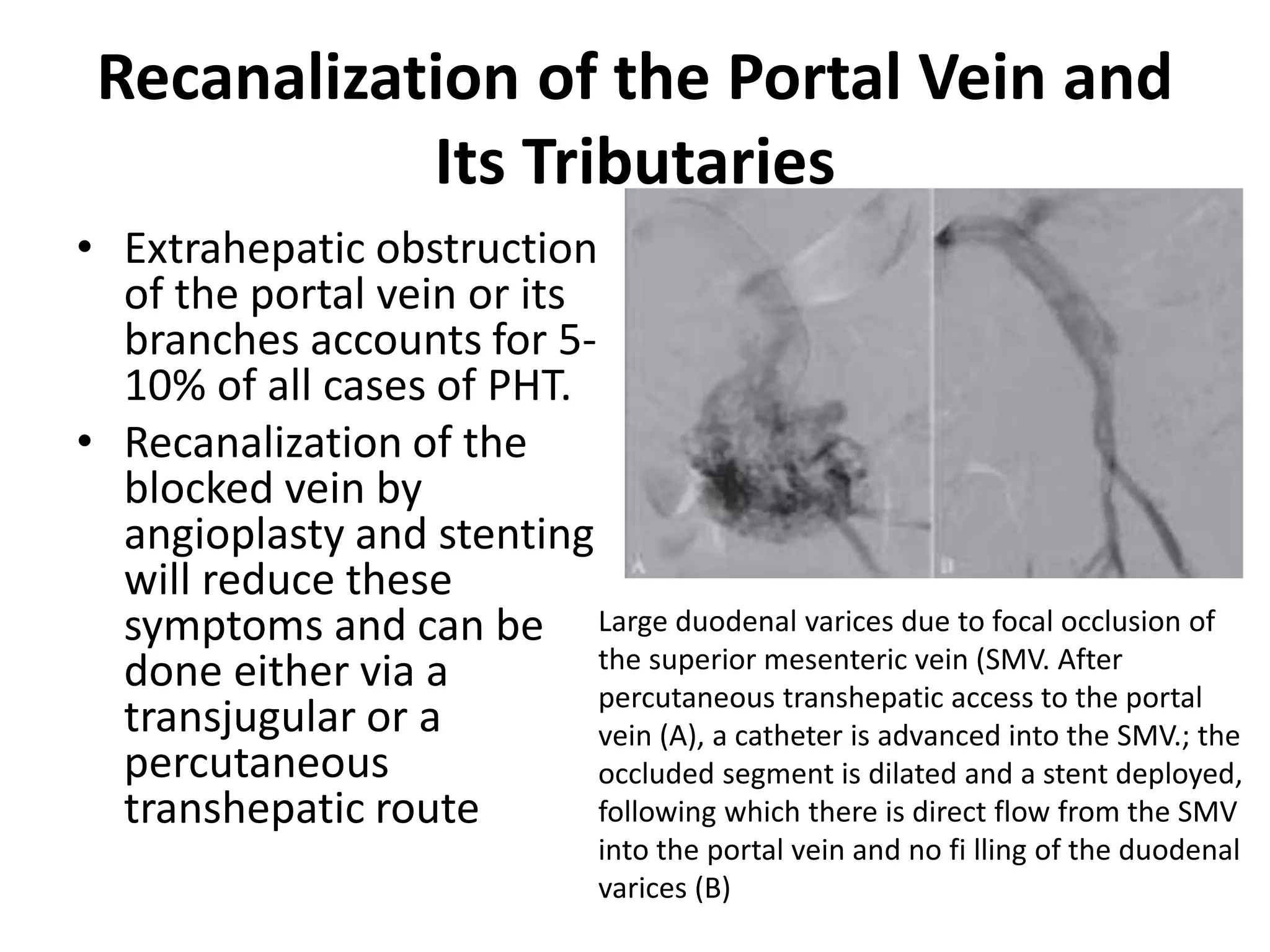 Radiology in portal hypertension | PPTX