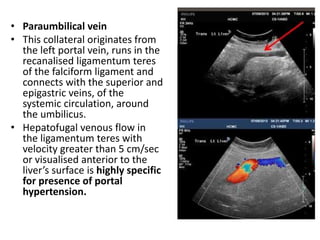 Radiology in portal hypertension | PPTX