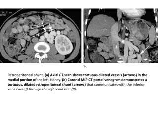 Teaching Atlas Of Vascular And Non-vascular Interventional