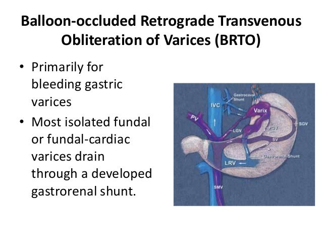 Radiology in portal hypertension