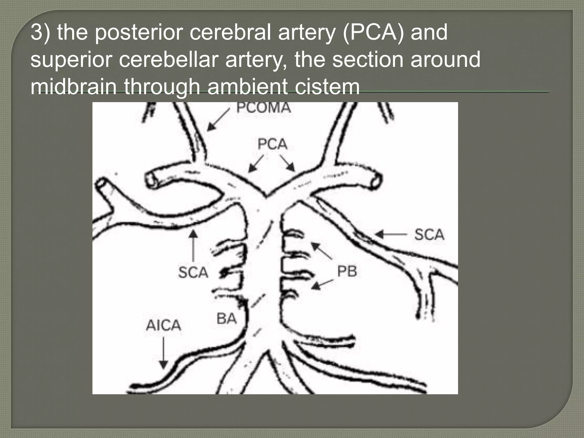 Radiology intervetion neuro | PPTX