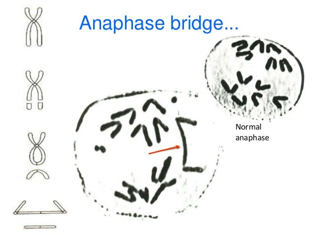 cancer and radiation