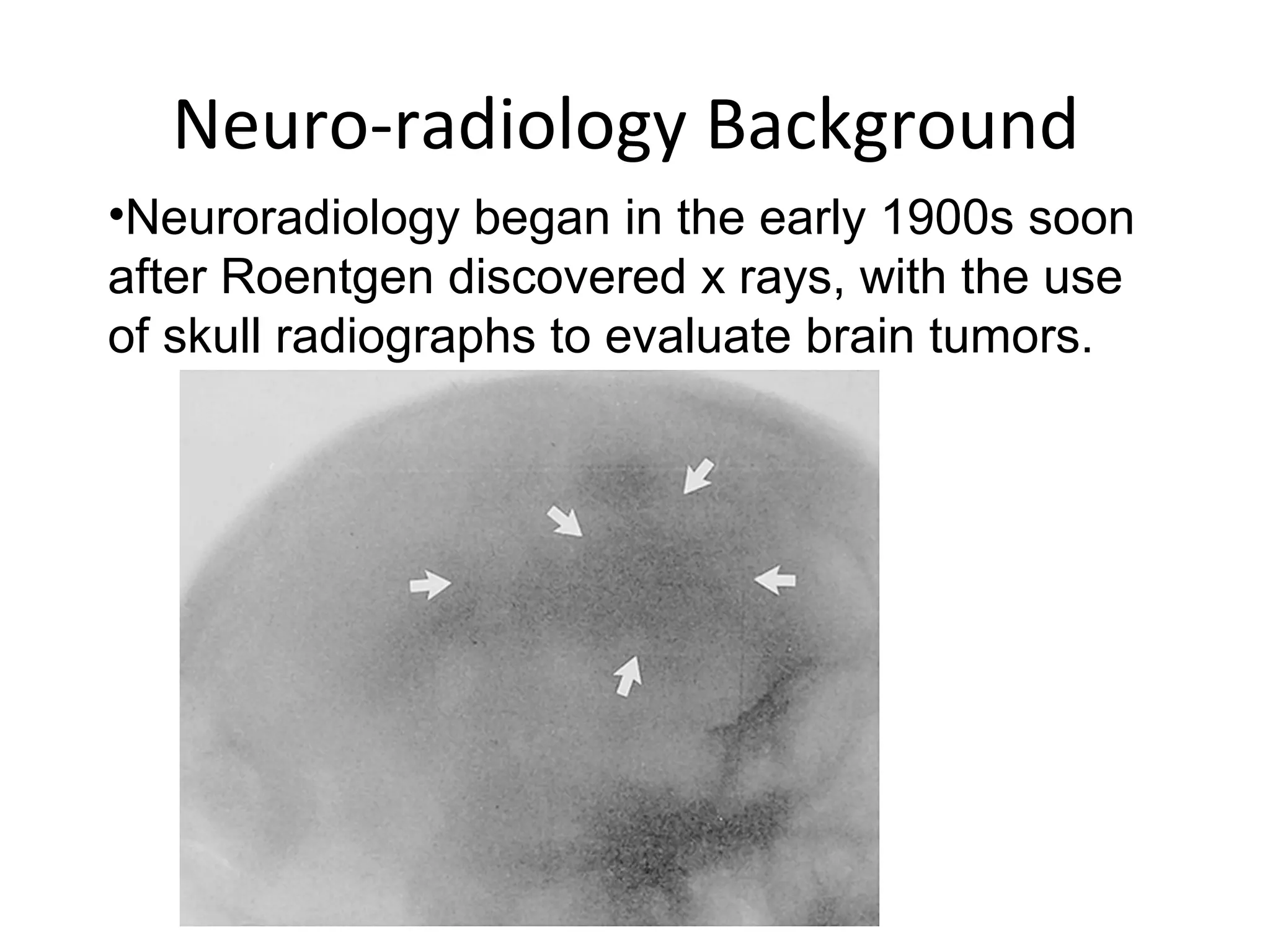 Radiology of central nervous system | PPT