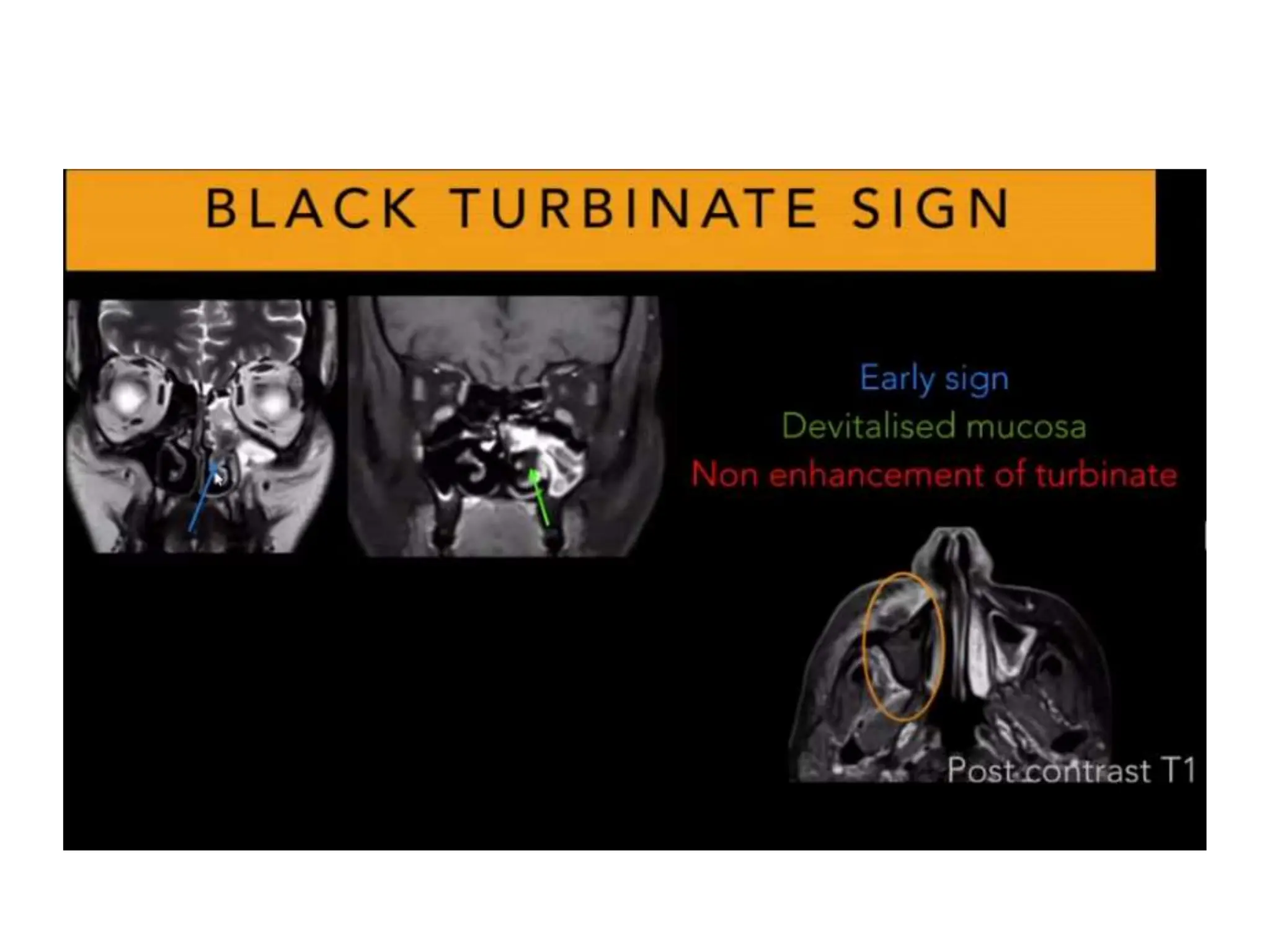 radiology imaging mri brain radiology meet feb24.pptx