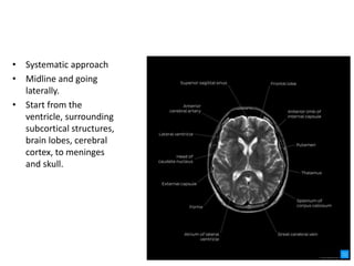 radiology imaging mri brain radiology meet feb24.pptx