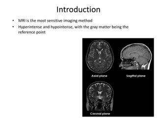 radiology imaging mri brain radiology meet feb24.pptx
