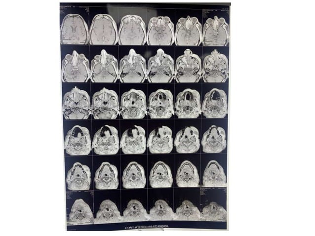 radiology imaging mri brain radiology meet feb24.pptx