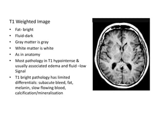 radiology imaging mri brain radiology meet feb24.pptx
