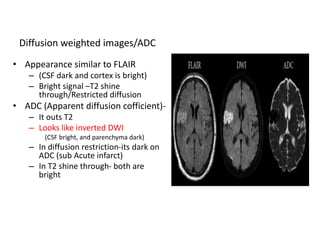 radiology imaging mri brain radiology meet feb24.pptx