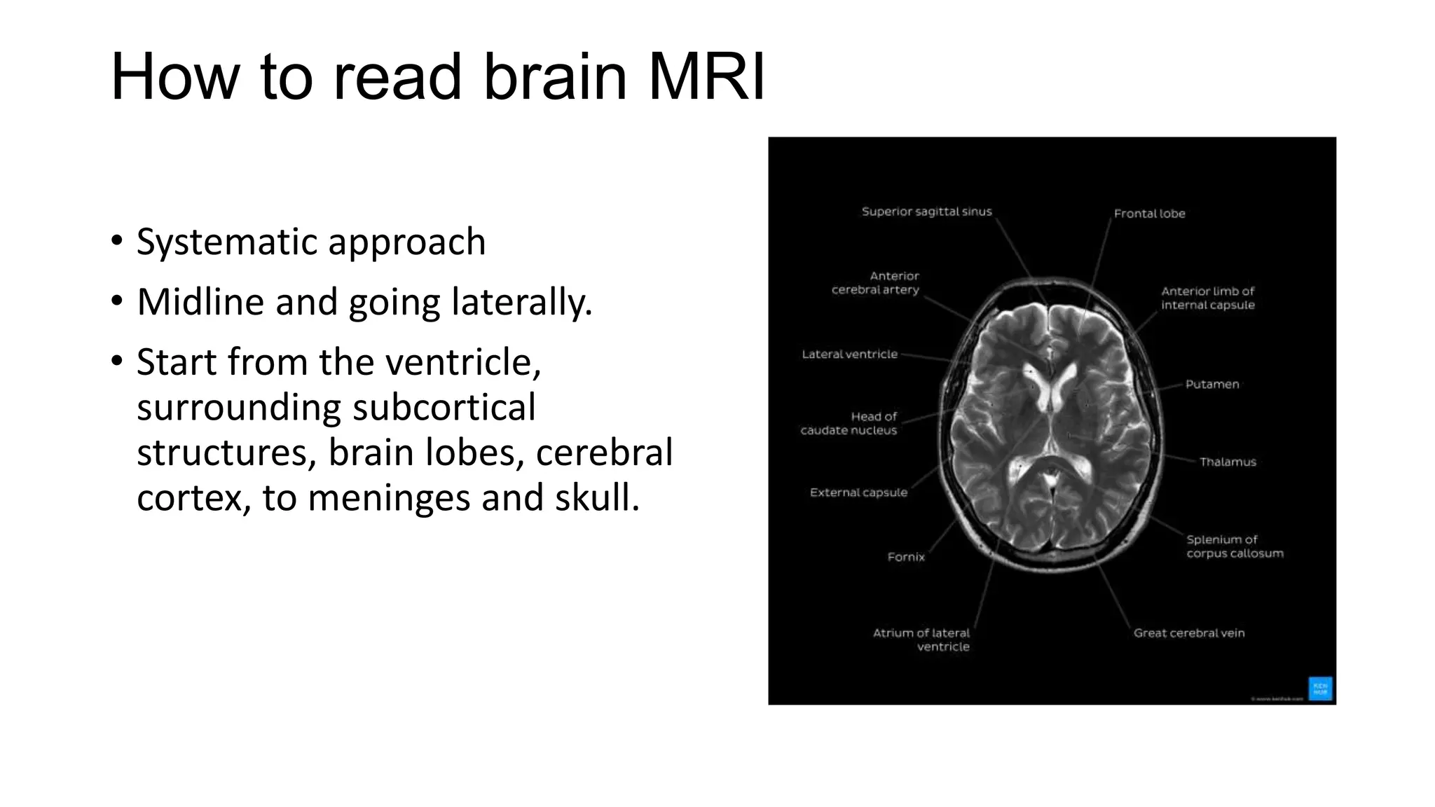 radiology ppt on mri sequences how to read basic mri sequences and ...
