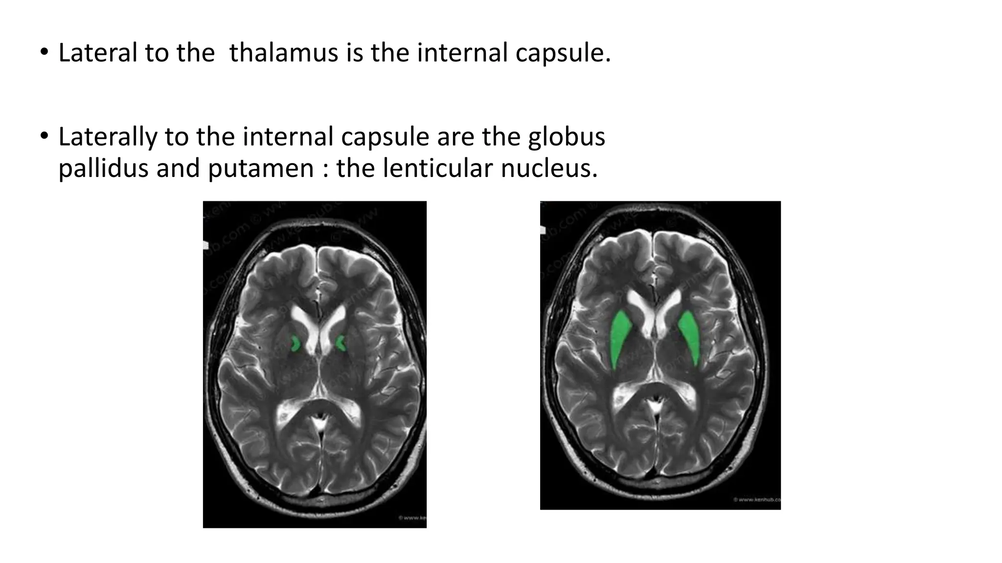 radiology ppt on mri sequences how to read basic mri sequences and ...