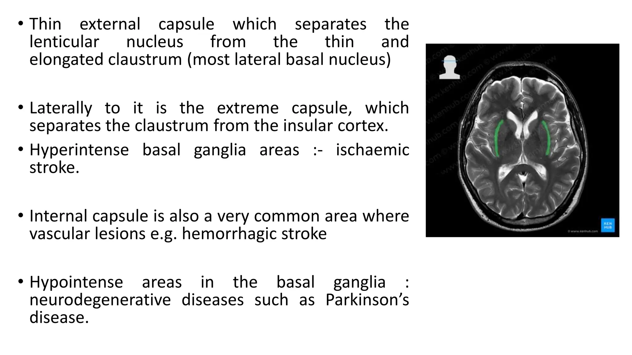radiology ppt on mri sequences how to read basic mri sequences and ...