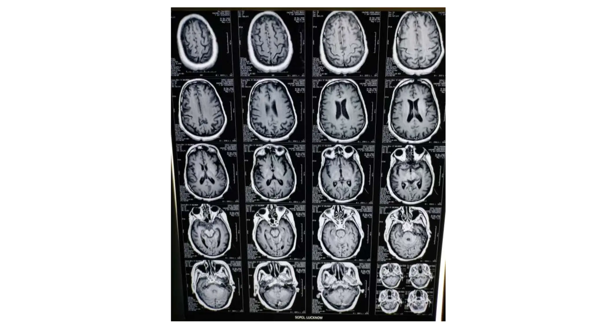 radiology ppt on mri sequences how to read basic mri sequences and ...