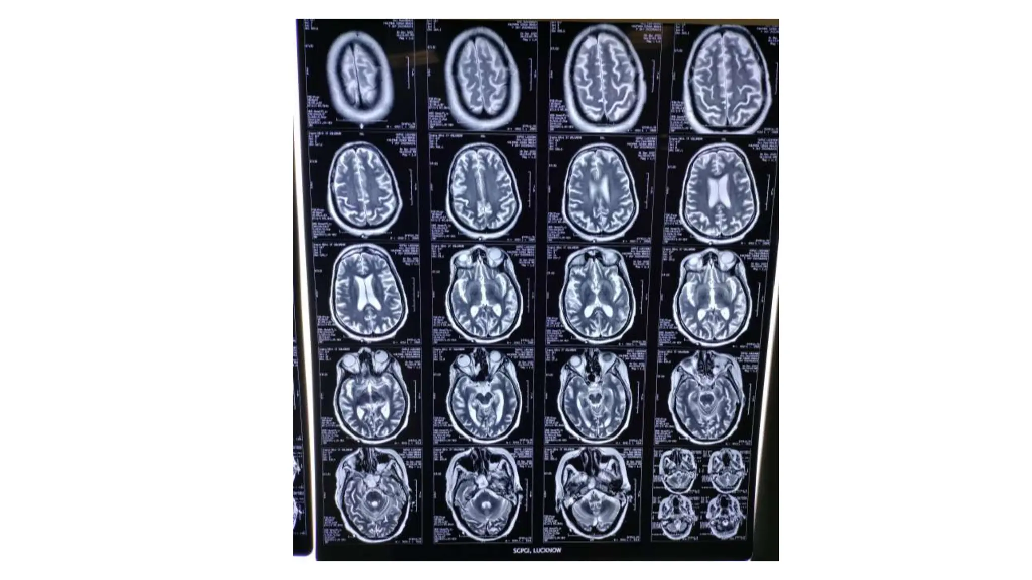 radiology ppt on mri sequences how to read basic mri sequences and ...