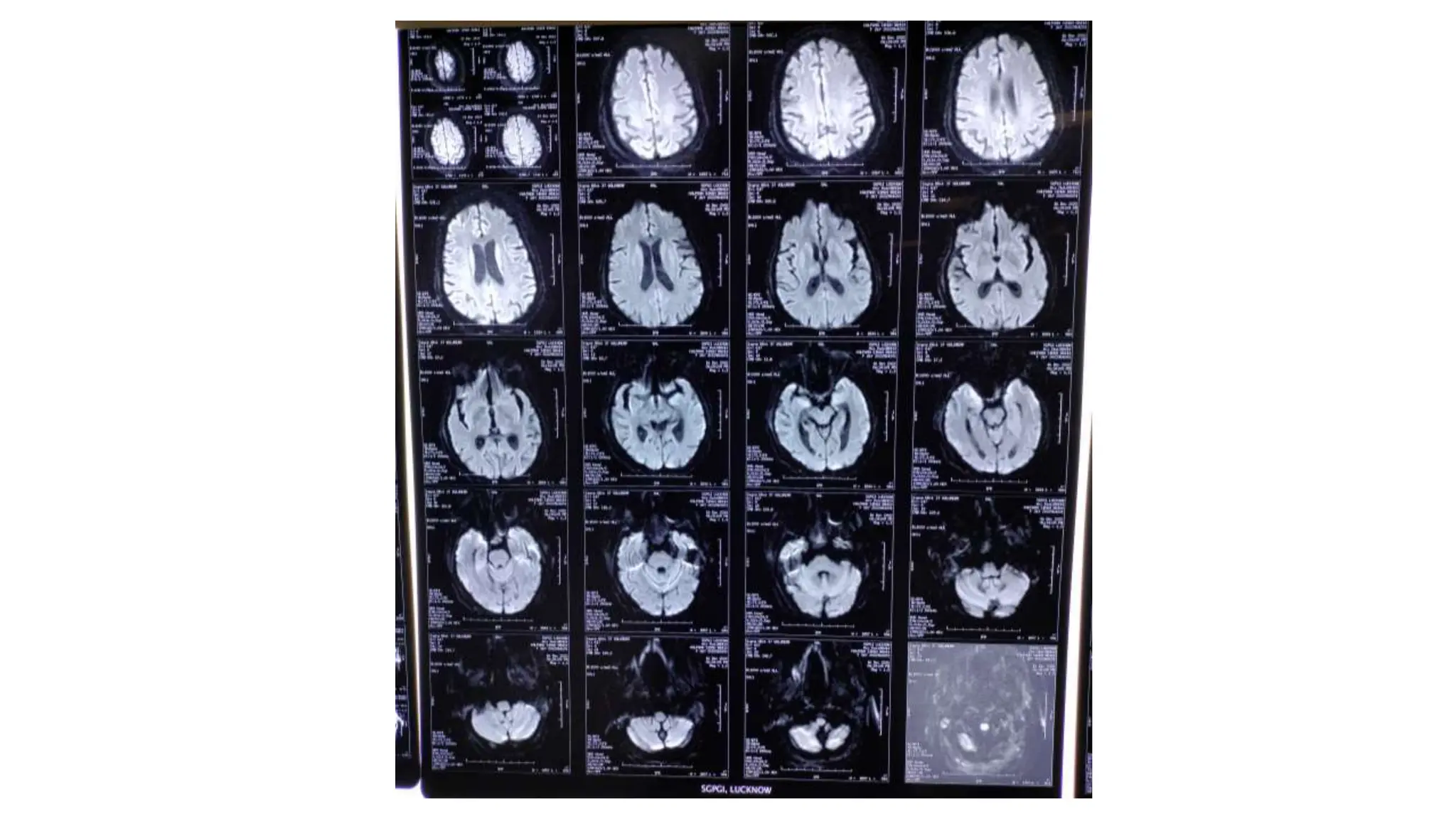 radiology ppt on mri sequences how to read basic mri sequences and ...