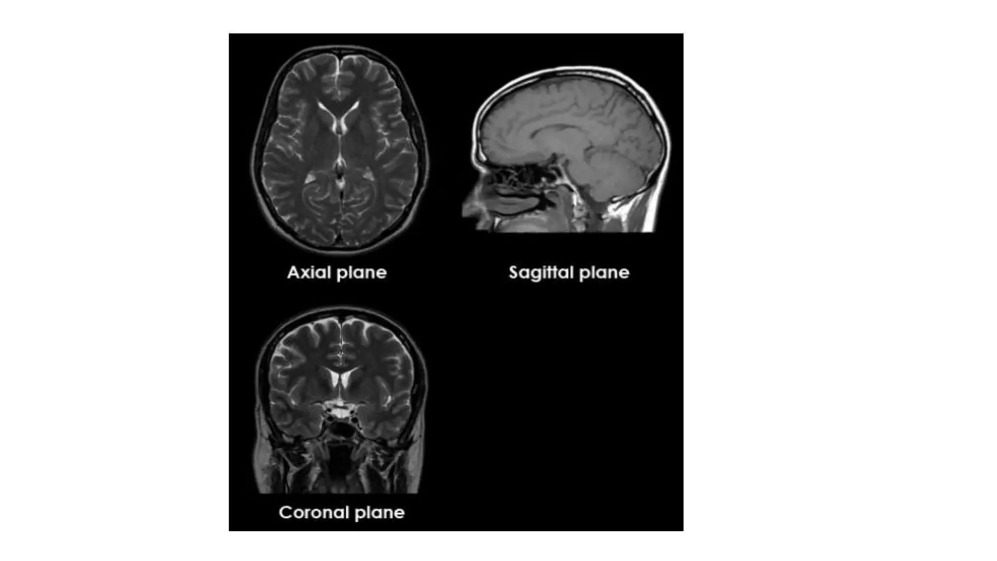 radiology ppt on mri sequences how to read basic mri sequences and ...