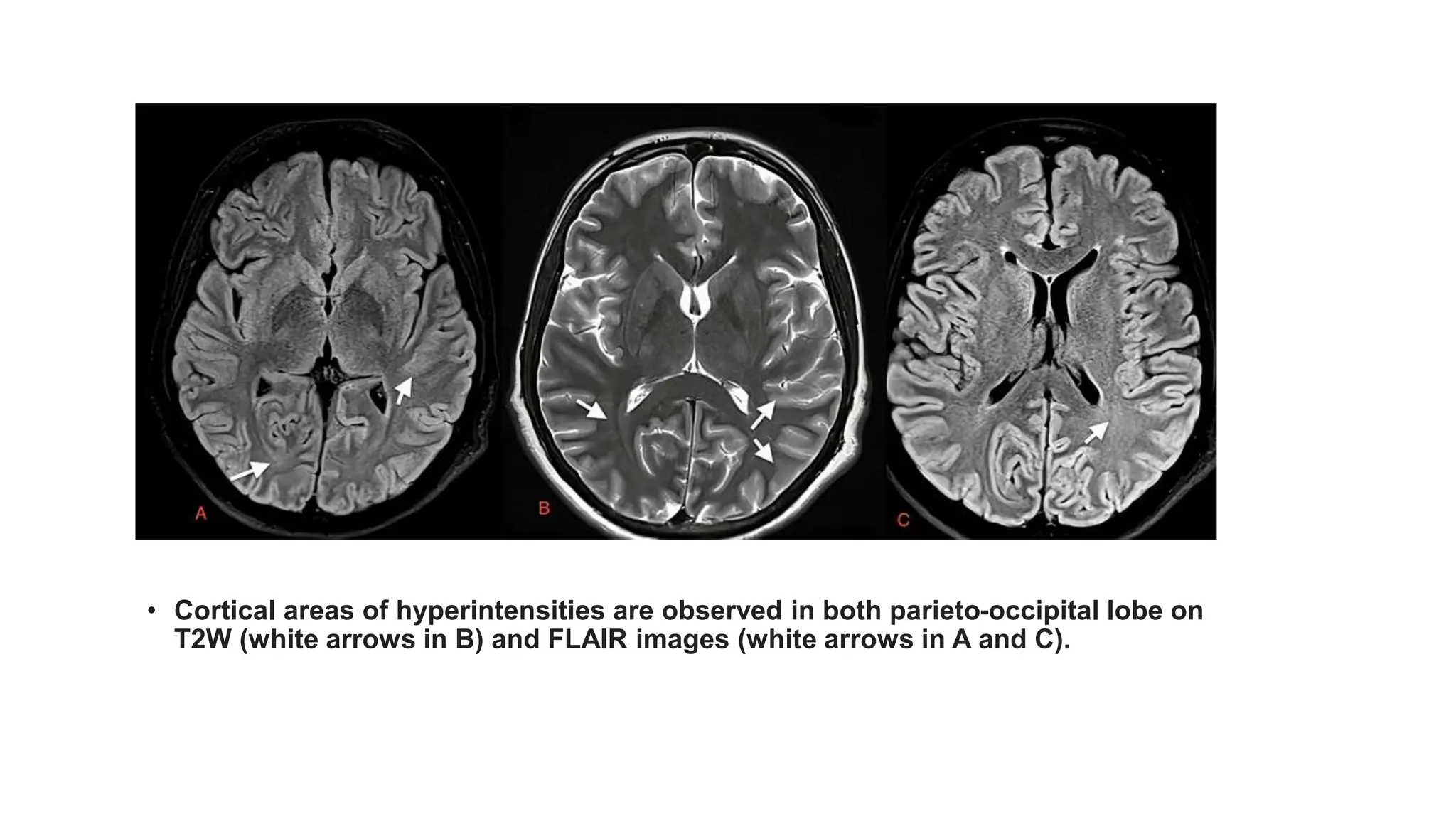 radiology ppt on mri sequences how to read basic mri sequences and ...