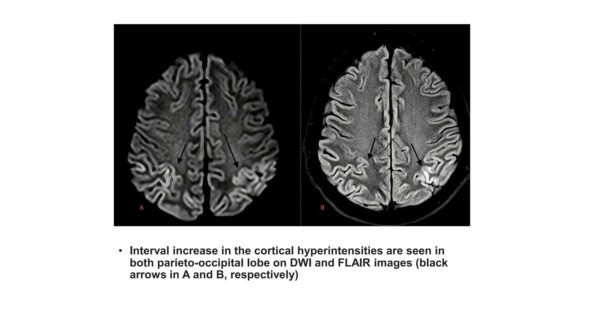 radiology ppt on mri sequences how to read basic mri sequences and ...