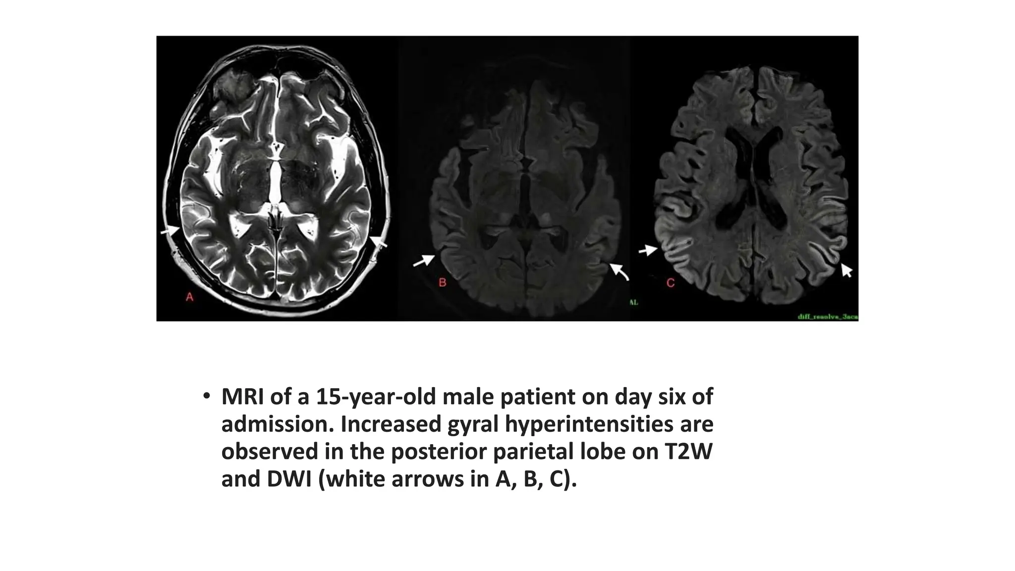 radiology ppt on mri sequences how to read basic mri sequences and ...