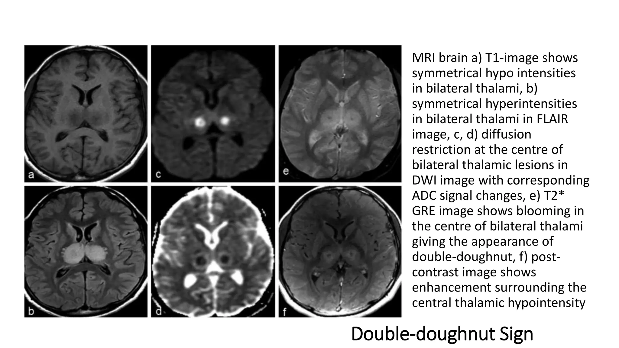 radiology ppt on mri sequences how to read basic mri sequences and ...