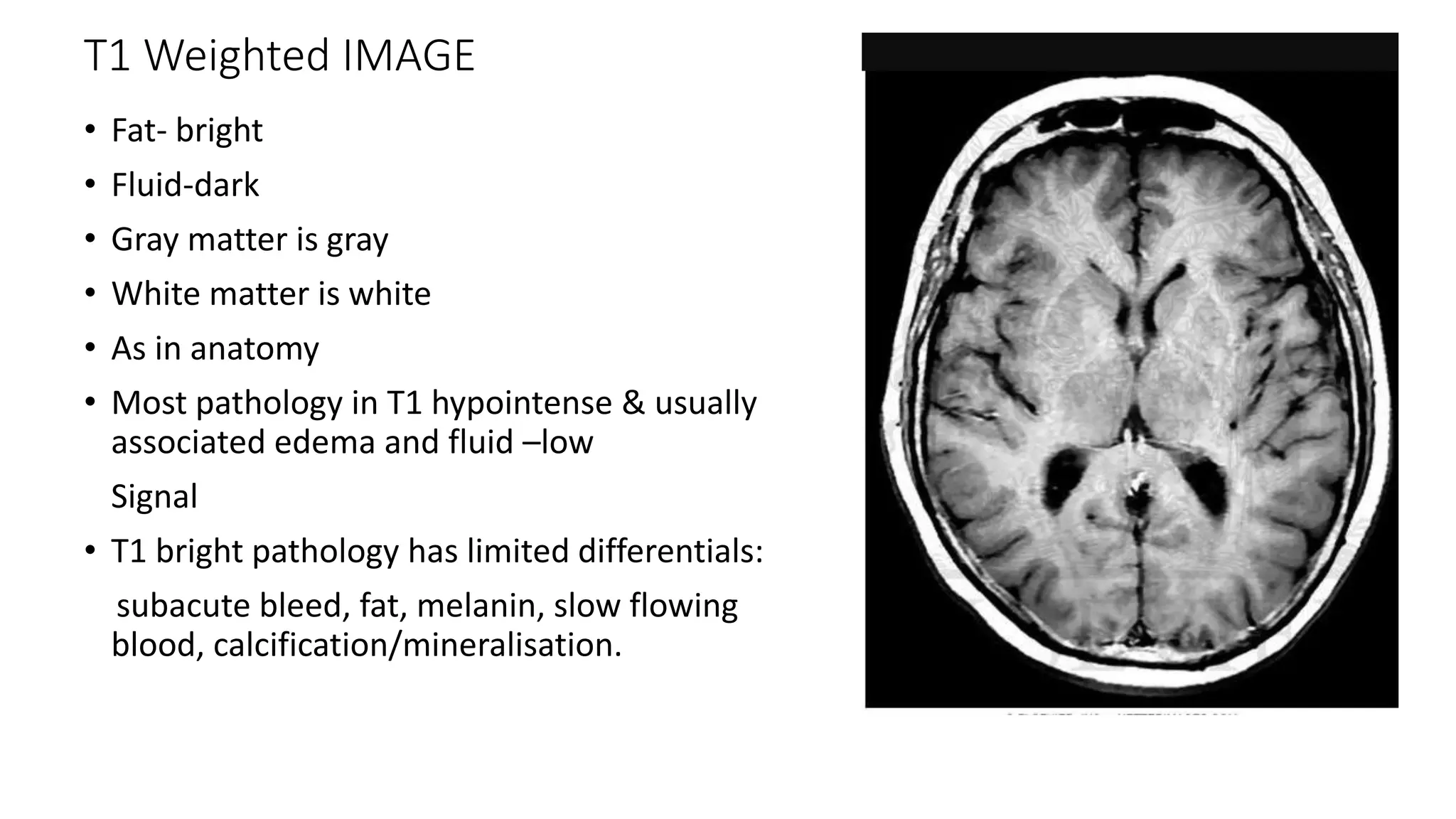 radiology ppt on mri sequences how to read basic mri sequences and ...