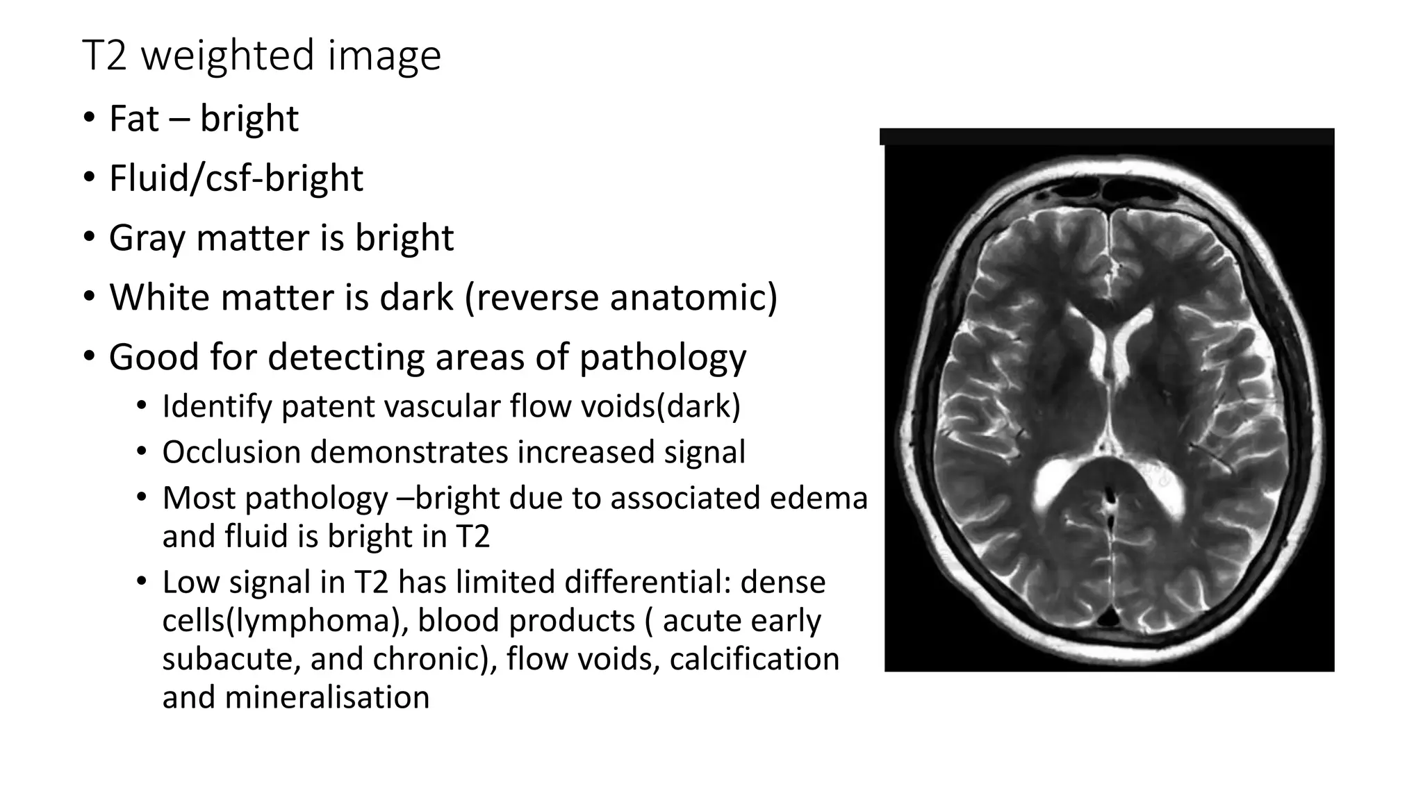 radiology ppt on mri sequences how to read basic mri sequences and ...