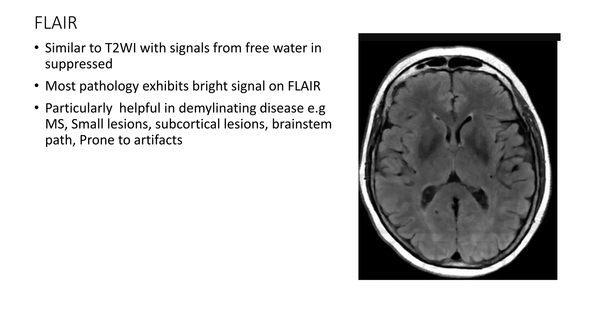 radiology ppt on mri sequences how to read basic mri sequences and ...